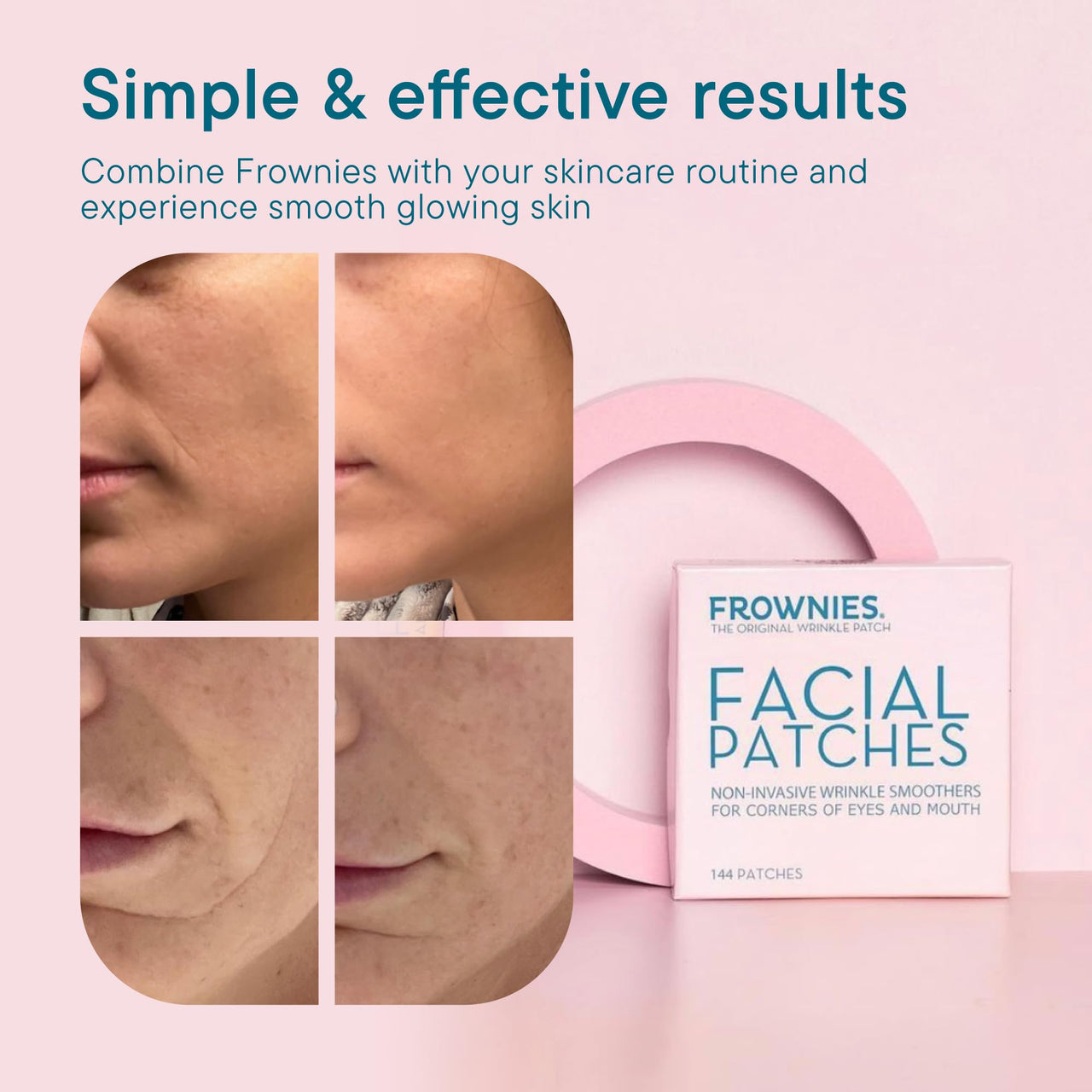 Buy Frownies Facial Patches for Wrinkles on the Corner of Eyes & Mouth ...
