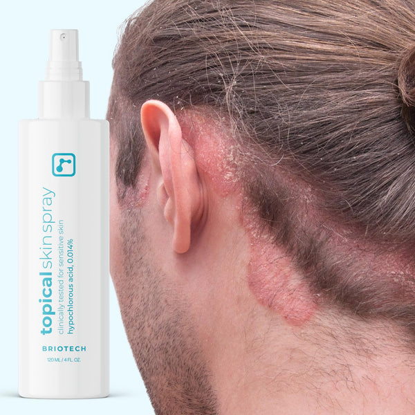 Buy BRIOTECH Topical Skin Spray, Hypochlorous Acid Spray for Body ...